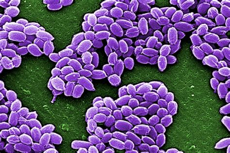 Chemists Recruit Anthrax To Deliver Cancer Drugs Mit News