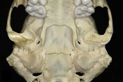 Mandibular Fossa