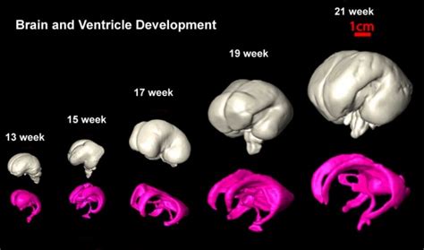 Neural Cerebrum Development Embryology