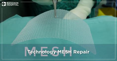 Technology Mesh Repair Strengthening The Abdominal Wall Reduction Of