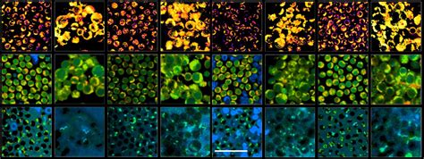 Label Free Imaging Of T Cell Activation Research Communities By