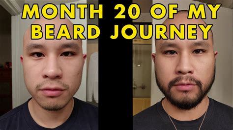 Minoxidil Beard 20 Months Into My Asian Beard Growth Journey Youtube