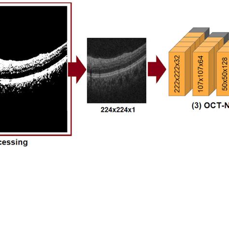 Pdf Classification Of Diabetes Related Retinal Diseases Using A Deep Learning Approach In