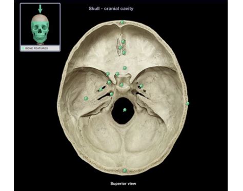 Cranial Cavity Identification Quiz