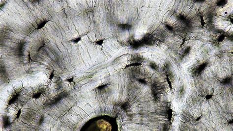 Osseous Connective Tissue