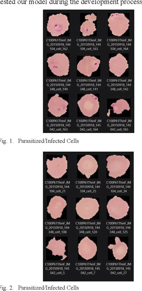 Figure 3 From Malaria Cell Image Classification Using Autoencoder Semantic Scholar