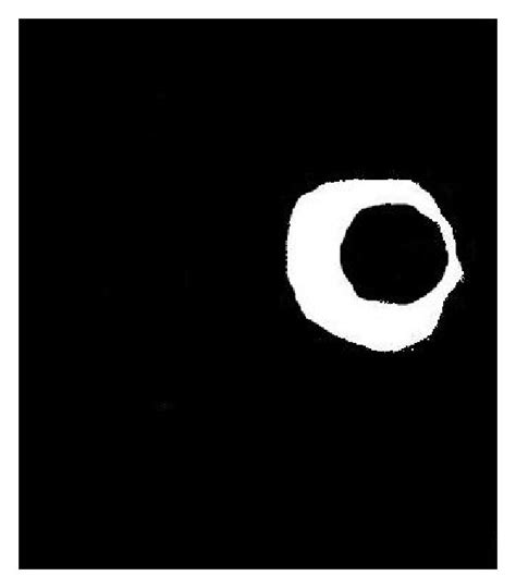 Manually Segmented Mri Brain Tissues A Wm B Gm C Csf D