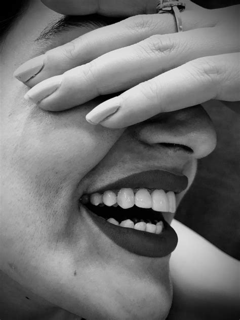 کامپوزیت ونیر