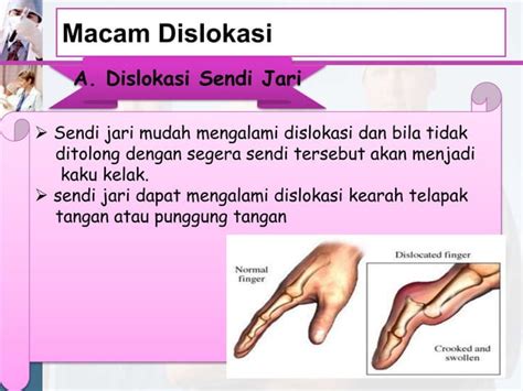 Dislokasi Keperawatanhhhhggfffttttfffrrrr Pptx