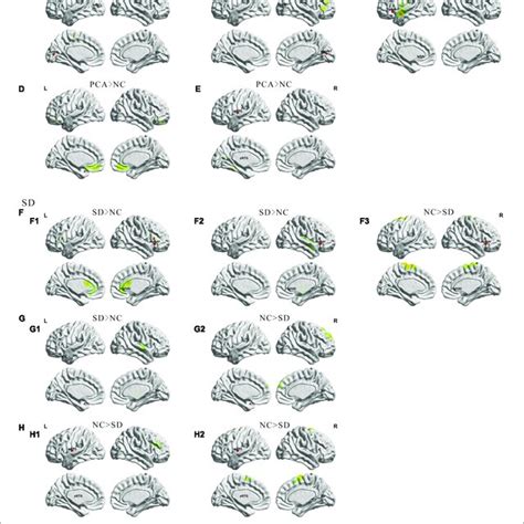 Group Differences In Regional Functional Connectivity From Seed Download Scientific Diagram