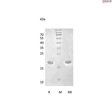Recombinant Human Interleukin 1 Beta Rhil 1b