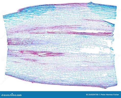 Sunflower Stem Helianthus Annuus Longitudinal Section 20x Micrograph