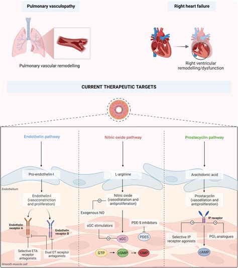 Pulmonary Arterial Hypertension Navigating The Pathways Of Progress In