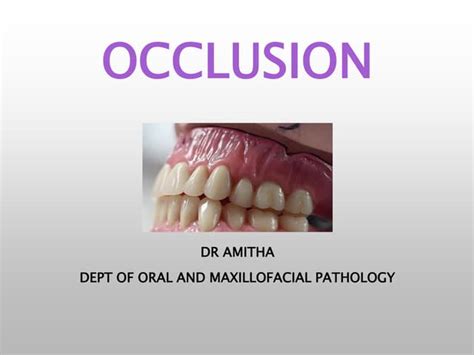 Occlusion In Complete Dentures Pptx