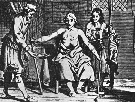 Transfuzija Krvi Hrvatska Enciklopedija