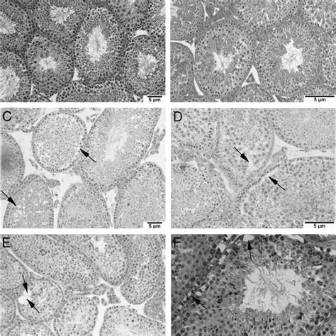 Hematoxylin Eosin Staining Of Testis Cross Sections In Black And White