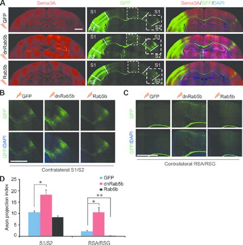 Inhibition Of Rab5 Causes Mistargeting Of Contralateral Callosal Axon Download Scientific