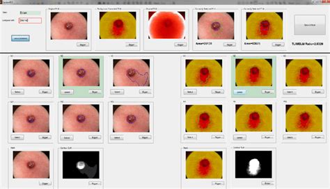The Interactive Segmentation Interface Download Scientific Diagram