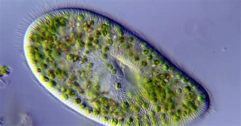 Under The Microscope Microplastics Features The Microbiologist