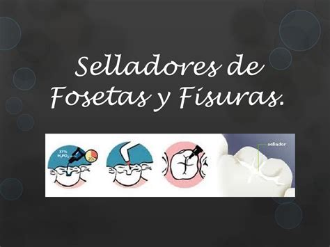 Eficacia De Selladores De Fosetas Y Fisuras Pdf Odontología Salud