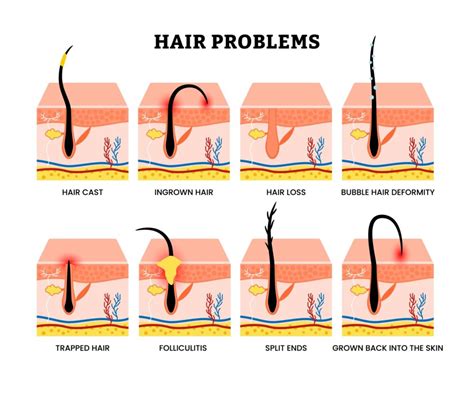 8 Common Hair Problems Causes Treatments And Solutions