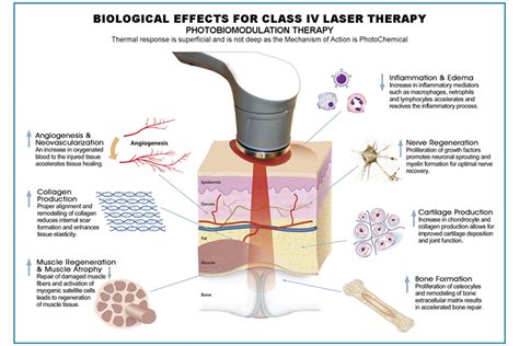 Class Iv Laser Singh Foot And Ankle Healing Center