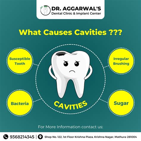 What Causes Cavities Dental Clinic Cavities Dental Hospital