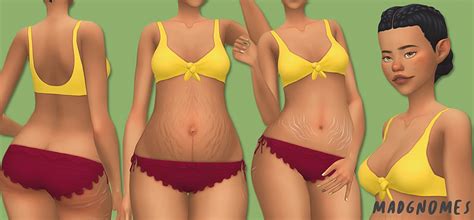 Anonymous Asked Hello Favorite Stretch Marks Face Tumbex