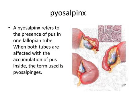 Ppt Pathological Female Reproductive System Powerpoint Presentation