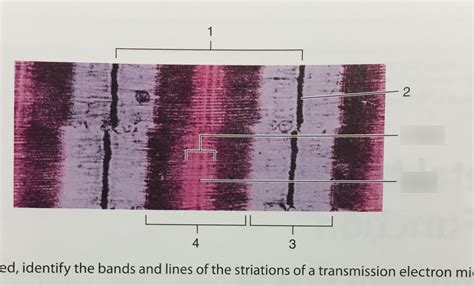 42 Label This Transmission Electron Micrograph