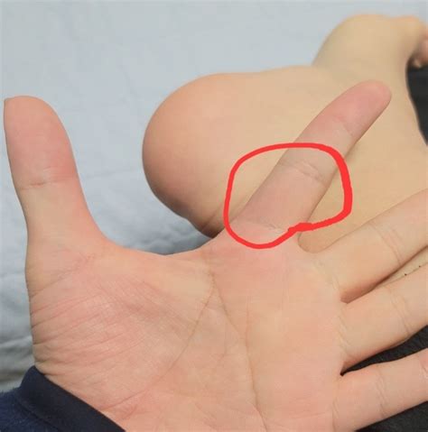 두번째 손가락이 아파요 지식in