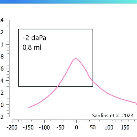 Type A Tympanometric Curve Equipment Audiosmart Neurosoft Image