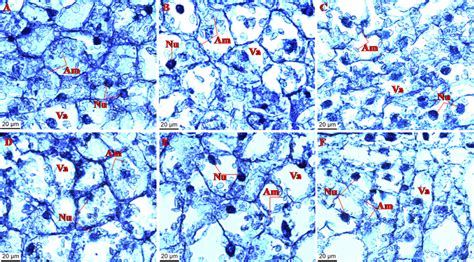 Micrographs Of Different Endosperm Regions In Wheat Grains At 6 Dap Download Scientific
