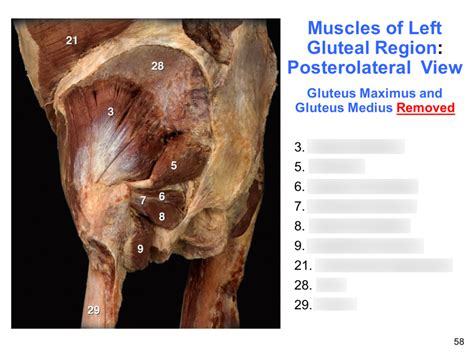 Muscles Of Left Gluteal Region Posterolateral View Diagram Quizlet