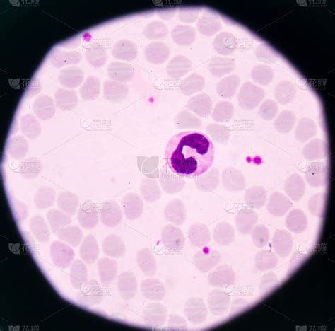 带状中性粒细胞医学背景。