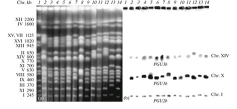 Pulsed Field Gel Electrophoresis Of Chromosomal Dna Of S Bayanus