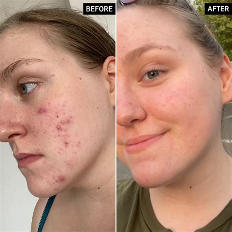 The Ordinary Glycolic Acid 7 Toning Solution Heygirl Pk