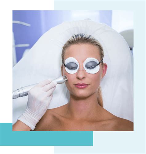 Co2 Laser Treatment And Aesthetic Medicine In Paris Doctor And Co