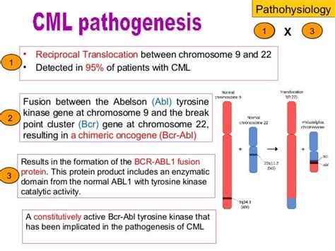 Chronic Myloid Leukemia Overview Cml