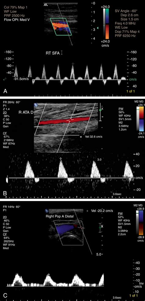 Vascular Laboratory Arterial Physiologic Assessment Clinical Tree