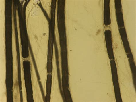 Teased Myelinated Nerve Fiber Slide