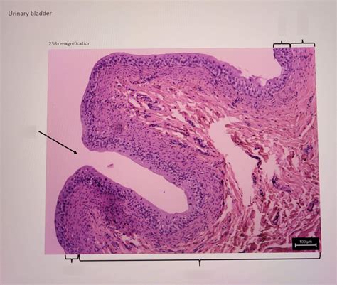 Aandp 2 Urinary Bladder Slide Diagram Quizlet