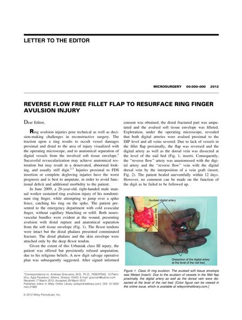 Digital Article Delivery Services On Linkedin Reverse