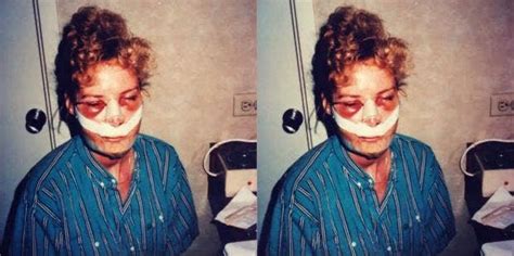 How Having A Facial Deformity Taught Me To Love All Of Myself Yourtango