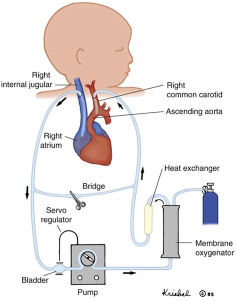 Neonatal And Pediatric Respiratory Care Clinical Gateclinical Gate