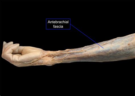 Antebrachial Fascia