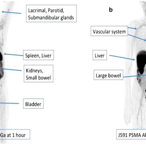 Biodistribution Of Two Different Pet Imaging Agents Showing Different