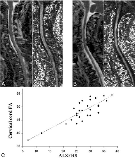 A And B Illustrative Examples Of MD Images On The Left Of Each Pair