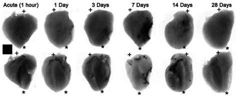 Photographs From The Epicardial Surface Top And Endocardial Surface