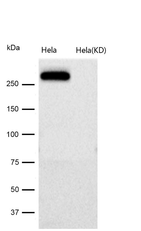 Chd3 Rabbit Mab Sab Signalway Antibody